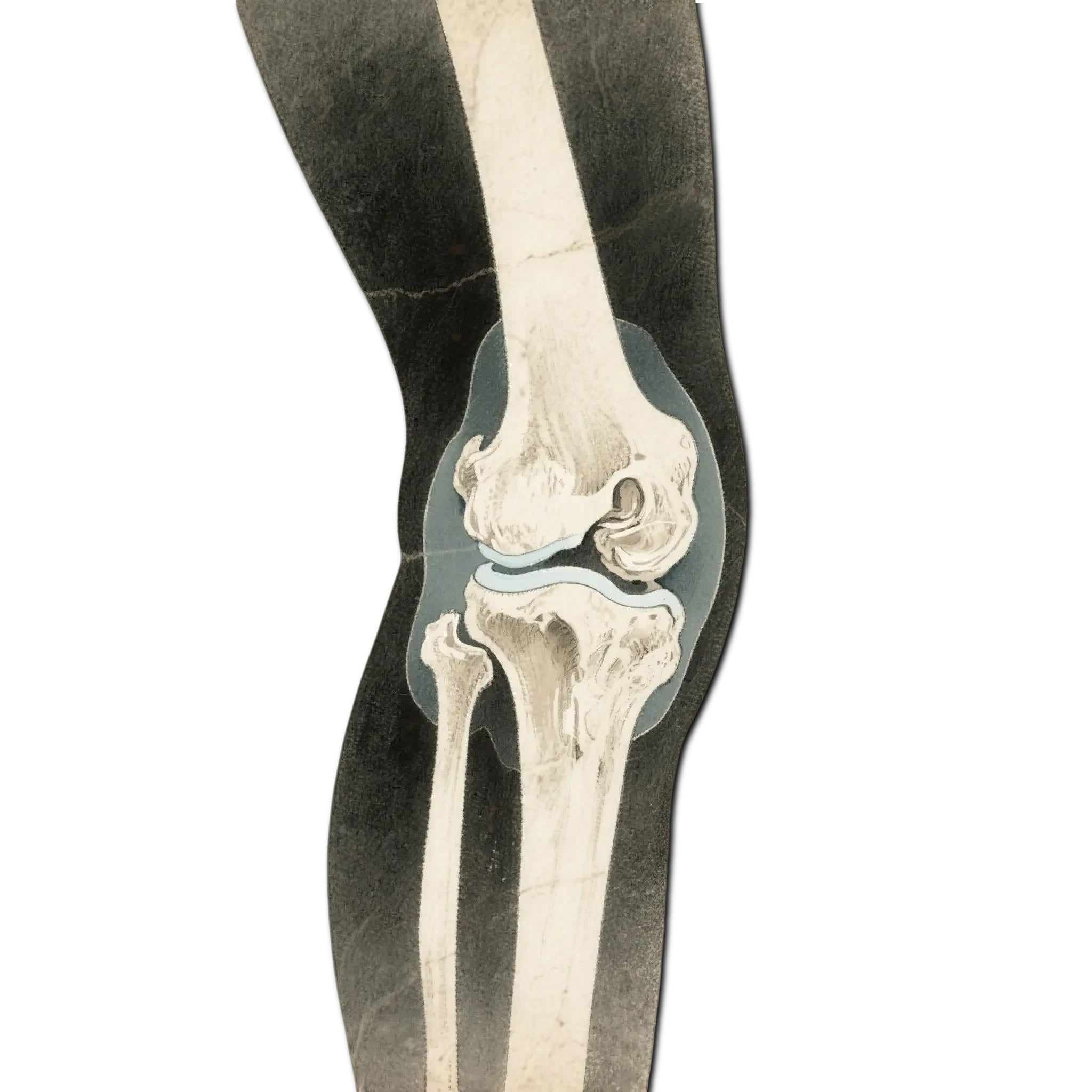 Joint Healing – TCM Hub